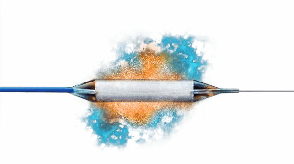 Optilume Urethral dilator balloon | Urology Alicante